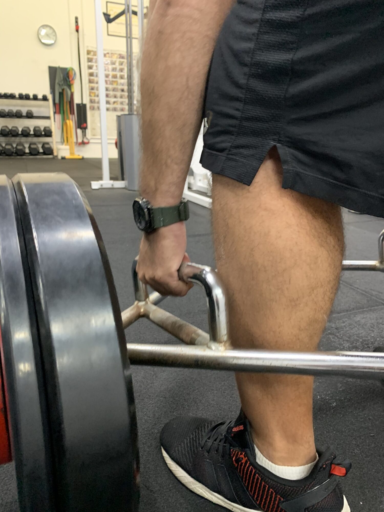 Pump Away Anxiety and Depression: Power of Resistance Training